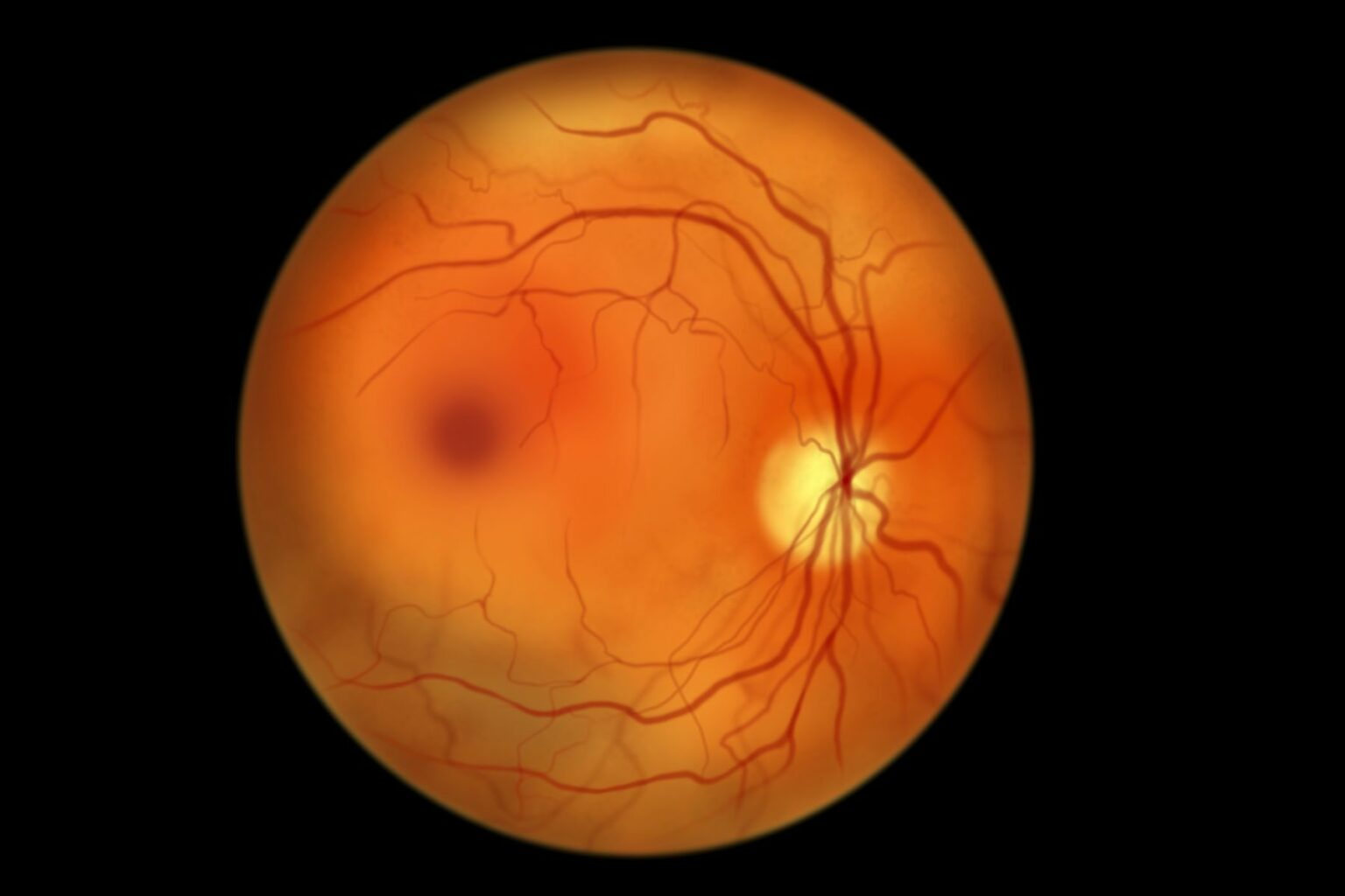 Why Dilated Eye Exams Still Matter in the Age of Advanced Imaging ...